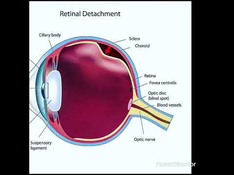 METHOTREXATE in Retinal Detachment Repair. - YouTube