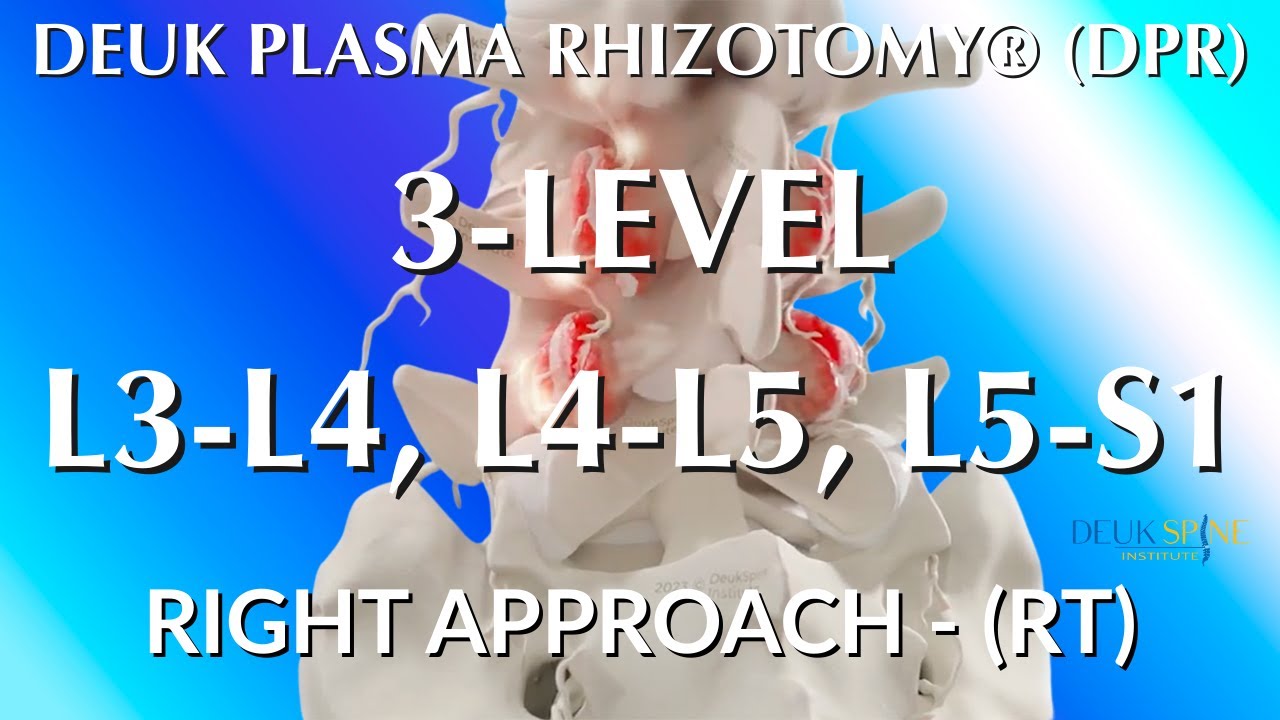 THORACIC PAIN - 2-LEVEL - T8-T9, T9-T10 - LIVE - LASER SPINE SURGERY ...