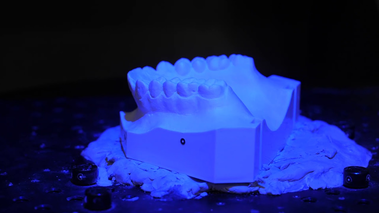 Orthocaps Aesthetic Aligner (Rocky Mountain Orthodontics) - YouTube