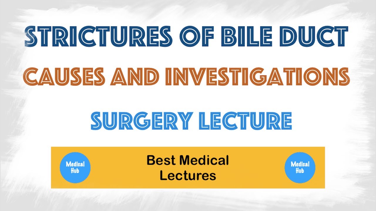 Stricture of Bile Duct : Causes and Investigations - YouTube