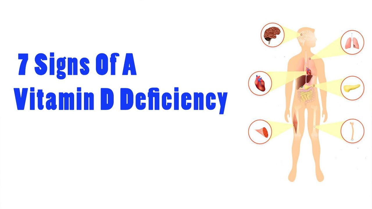 7 Signs Of A Vitamin D Deficiency | Health Vlogger - YouTube