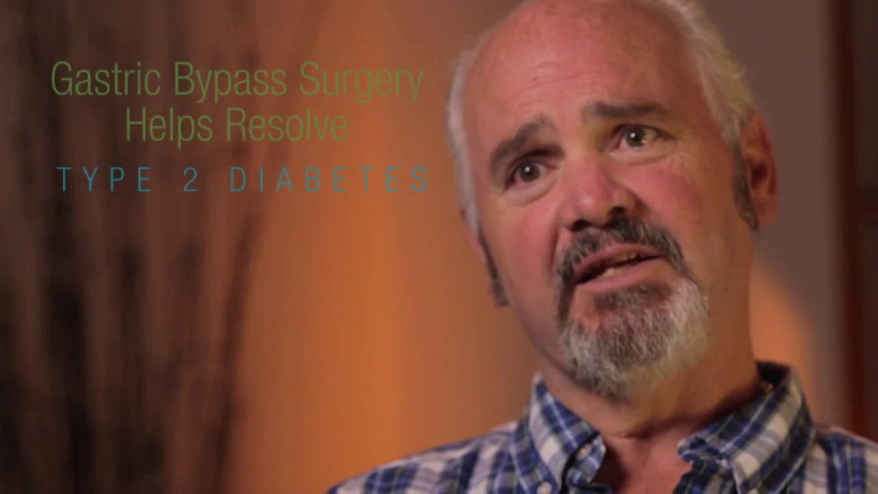 Clayton's Gastric Bypass Success Story - YouTube