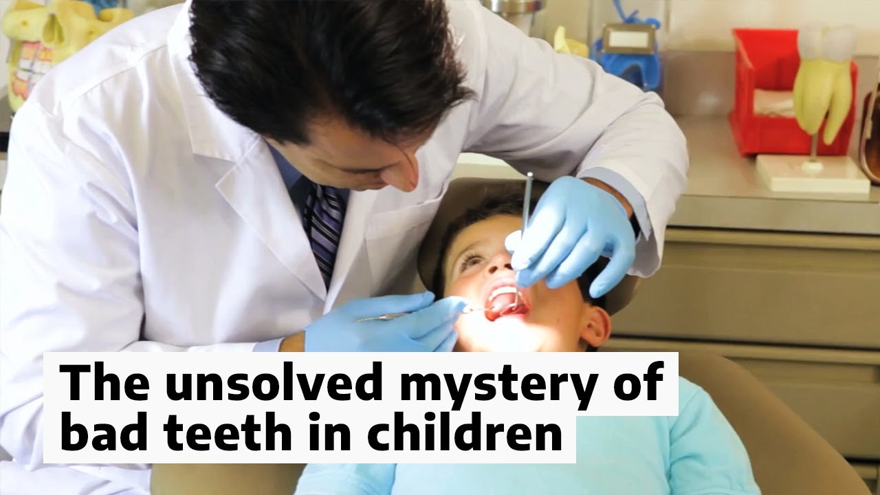 The unsolved mystery of bad teeth in children - YouTube