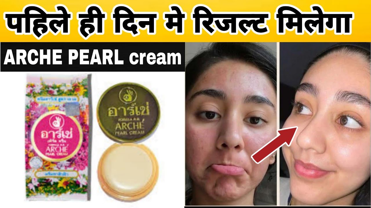 How to use || ARCHE PEARL Skin whitening cream, Acne pimples Remove ...