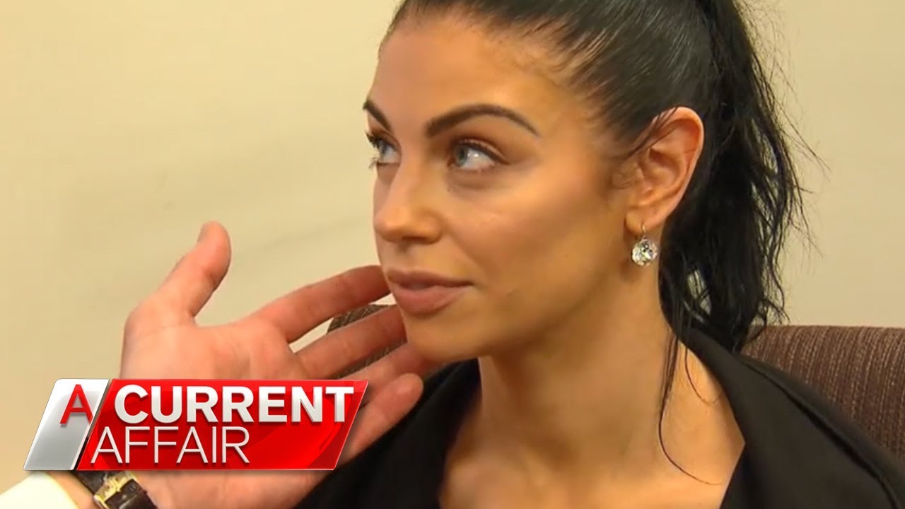 Cosmetic surgeon accused of disfiguring patients | A Current Affair ...