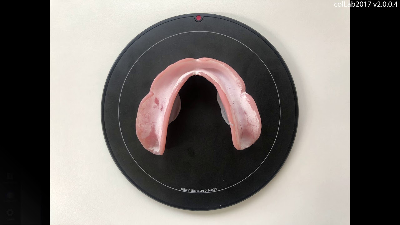 40 How To Replicate A Denture ColLab YouTube 40-how-to-replicate-a-denture-collab-youtube