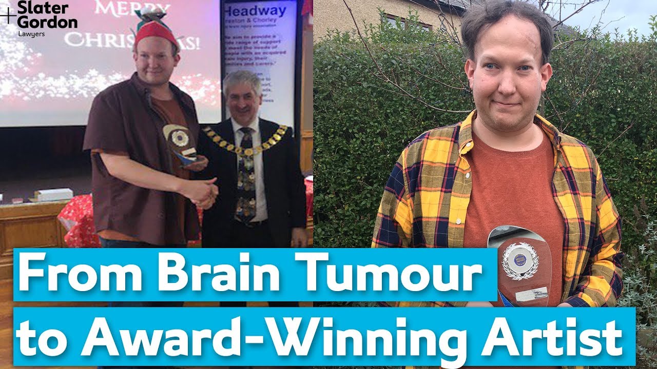 From Brain Tumour to Award-Winning Artist - YouTube