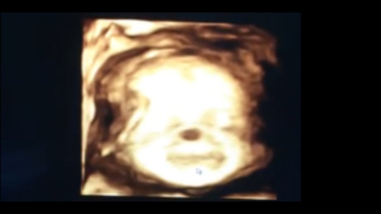 USG 4D Dimension | Usia 7 bulan kandungan - YouTube
