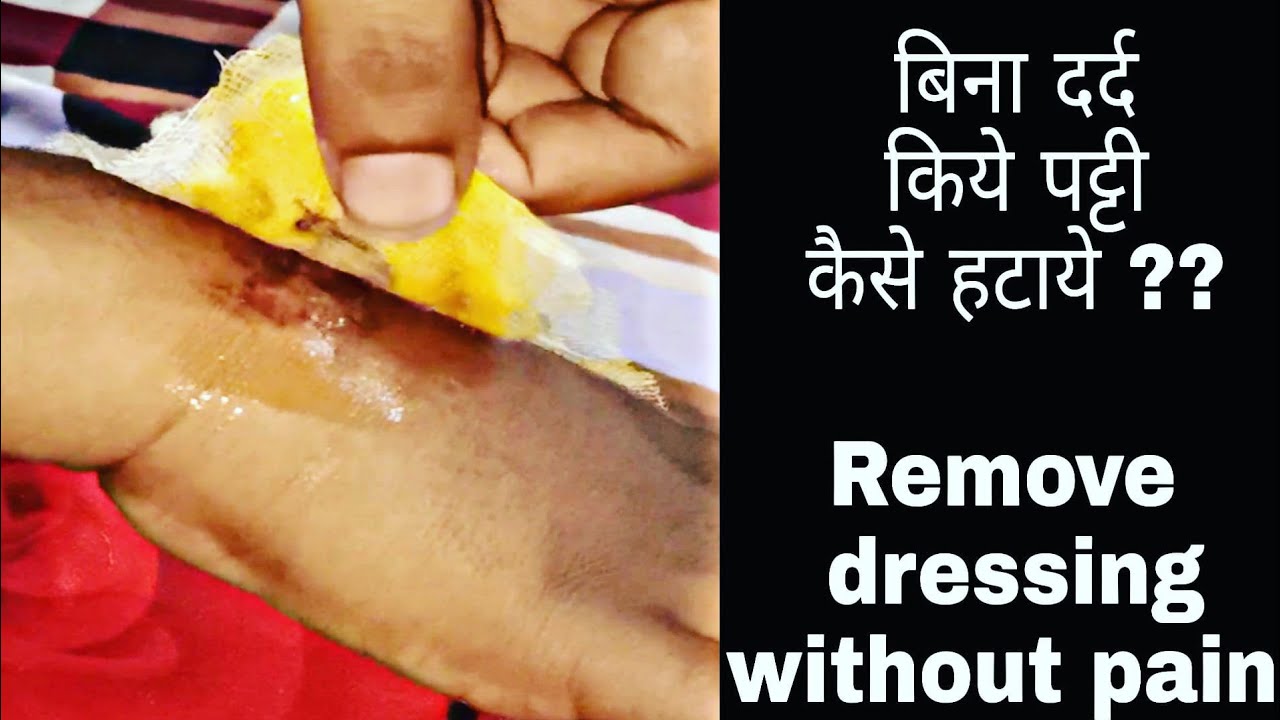 How To Remove Bandage From Wound Without Pain how-to-remove-bandage-from-wound-without-pain