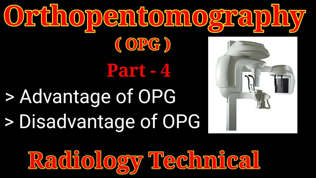 OPG # Orthopentomography # Part - 4# Advantage & Disadvantage of OPG ...