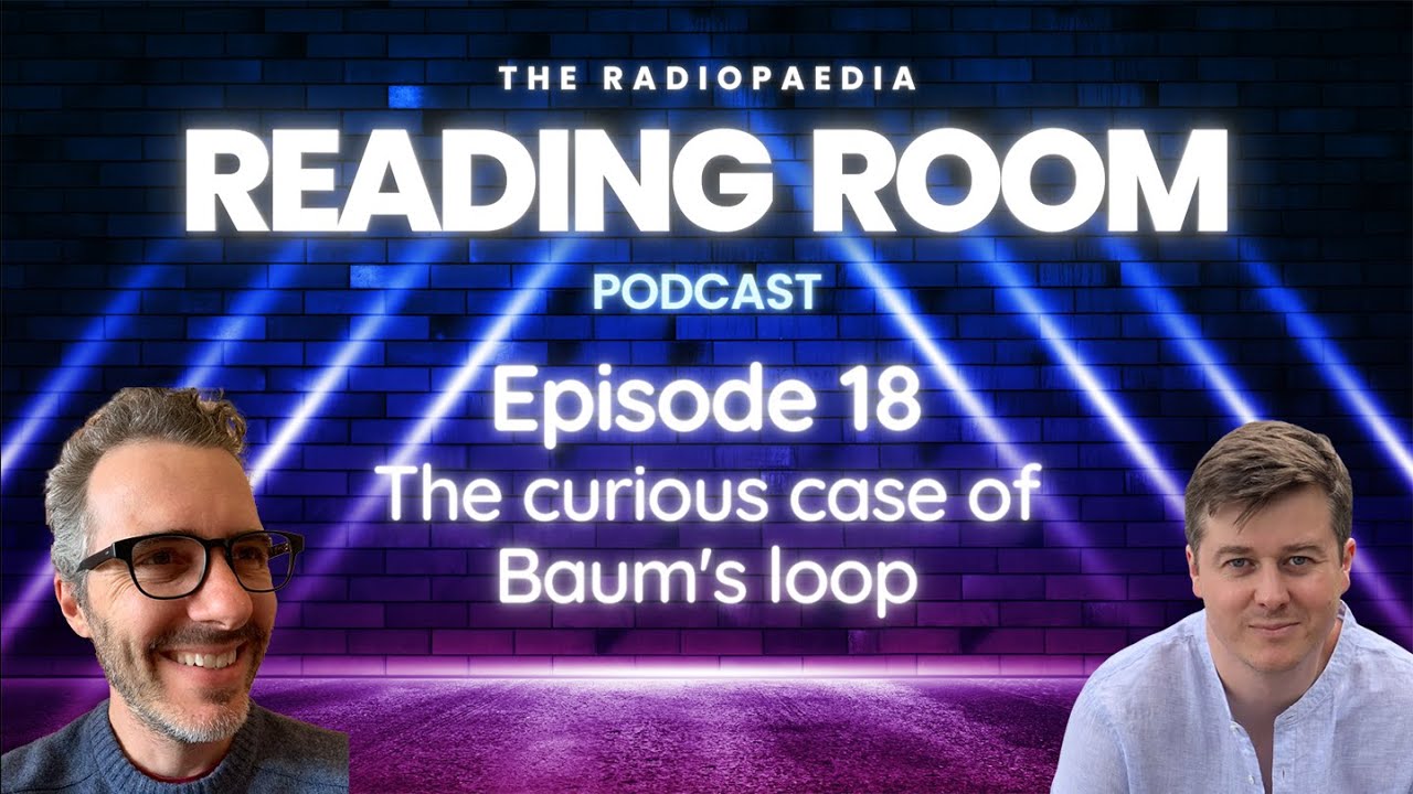 The curious case of Baum's loop with Frank Gaillard - YouTube