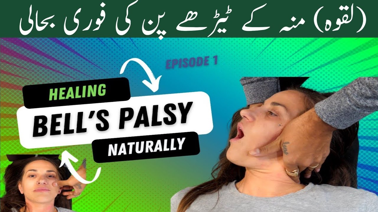 Bell's palsy (Laqwa)symptoms causes and treatment||Facial nerve ...
