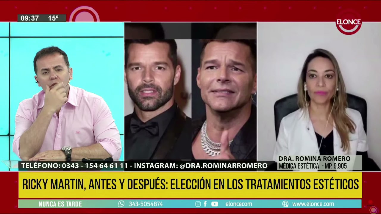 Ricky Martin, antes y después de tratamientos estéticos - YouTube