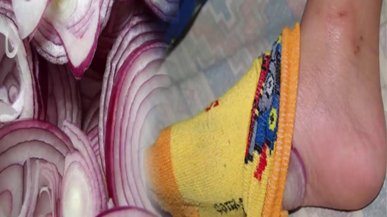 DISCOVER Why You Have To Sleep With An ONION ON YOUR FEET SURPRISING ...