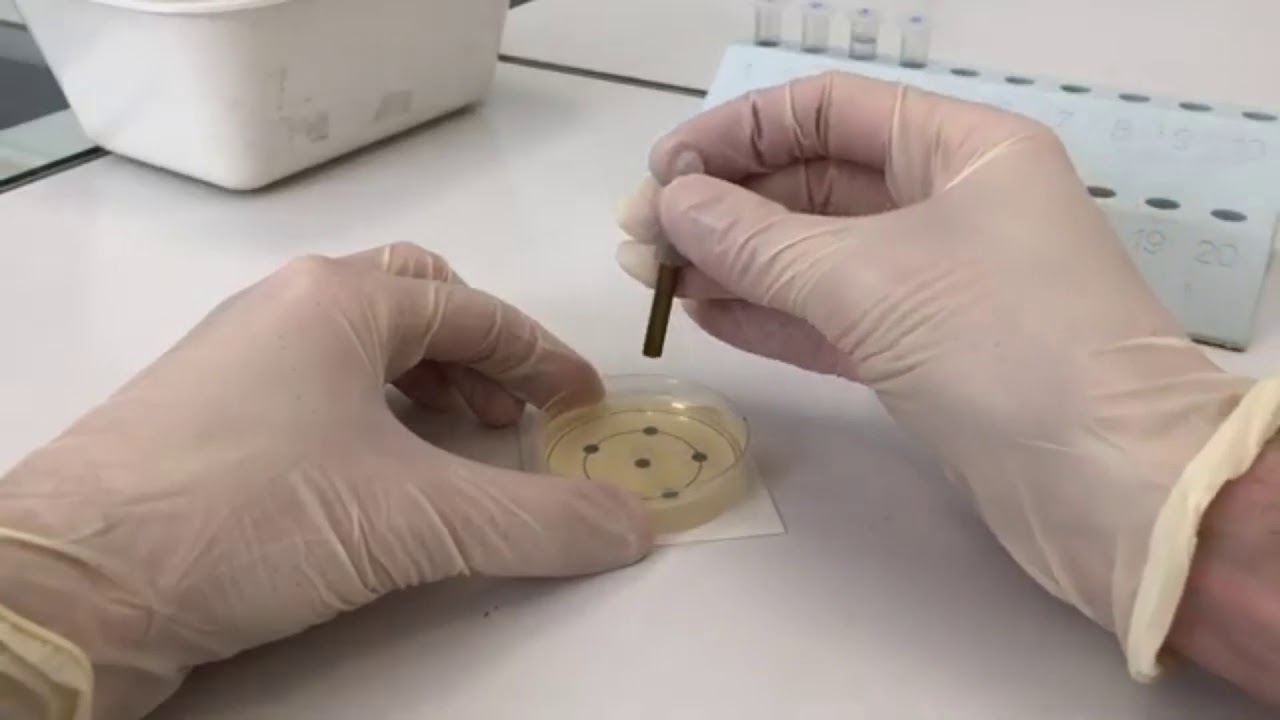Test Ouchterlony - YouTube