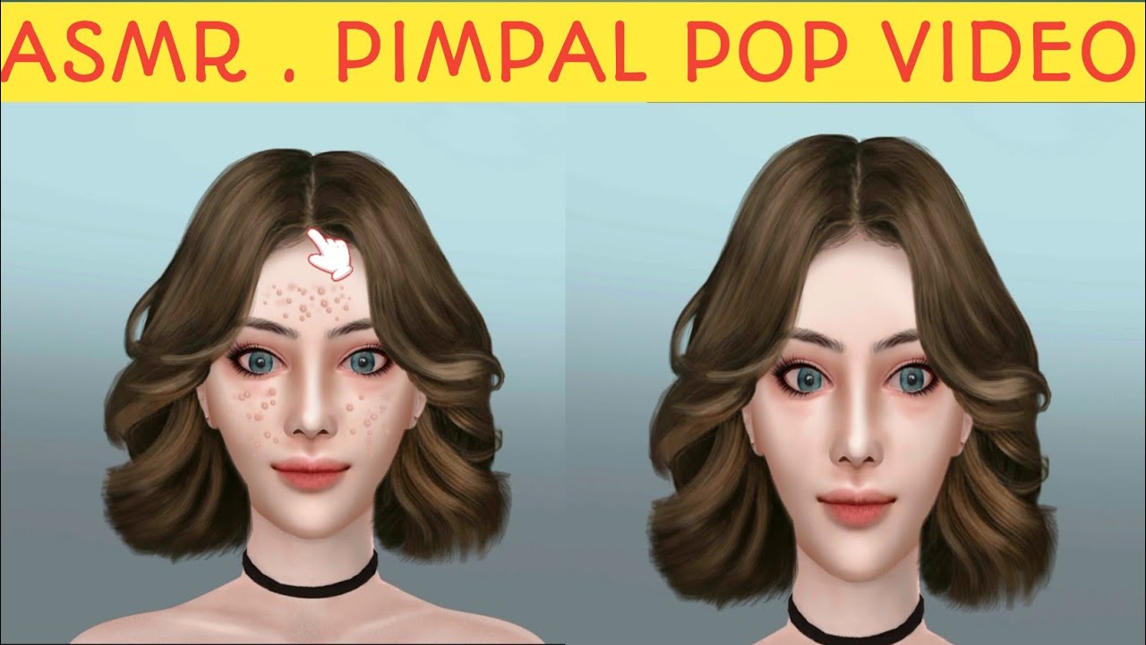 Asmr remove pimpal & acne dirty face clean.|deep cleaning animation ...