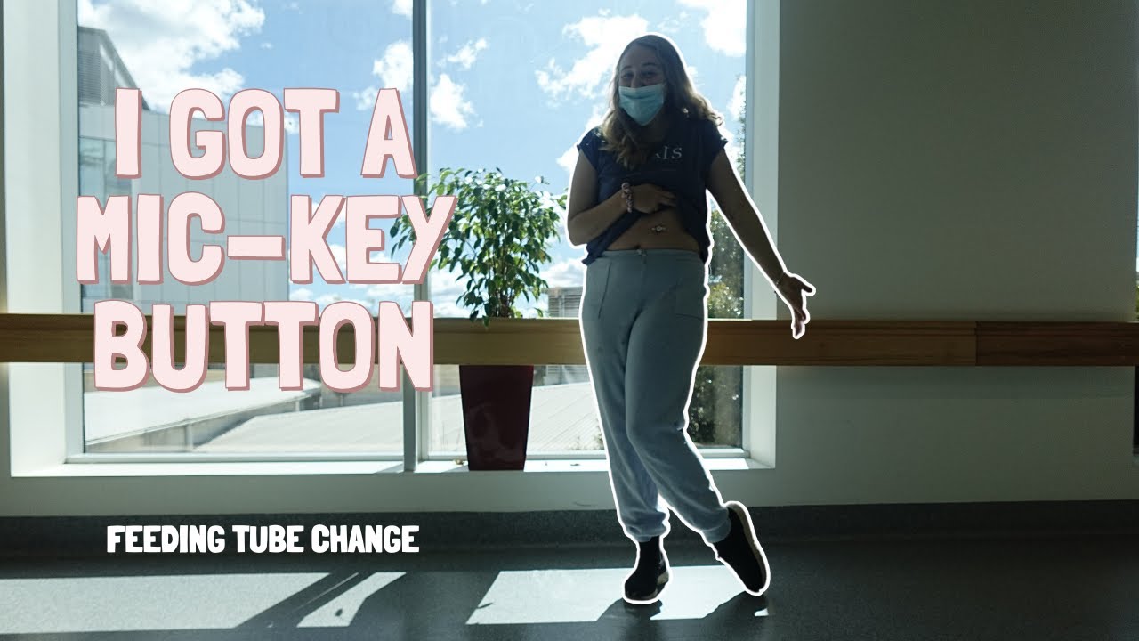 I Finally Got my Mic-Key Button Feeding Tube - YouTube