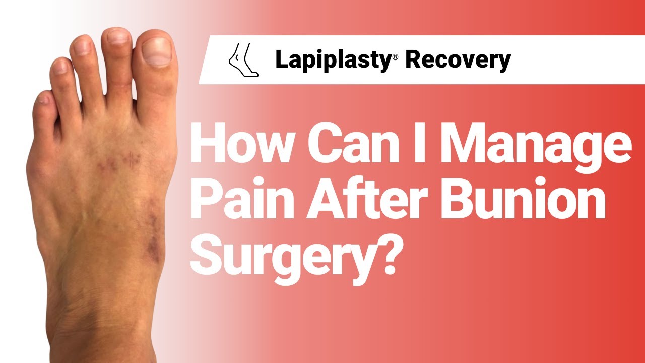 How Can I Manage Pain After Bunion Surgery? | Lapiplasty® Recovery ...