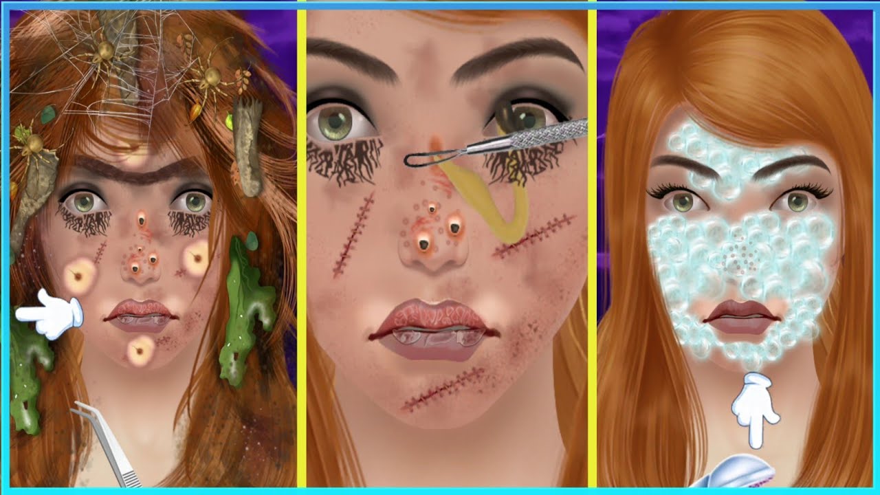 ASMR Facial Scar Treatment // Face Care 3d Animation - YouTube