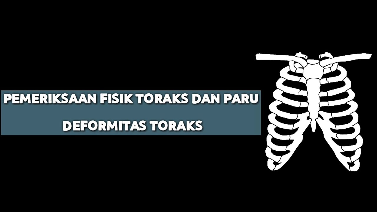 Pemeriksaan Fisik Toraks dan Paru: Deformitas Toraks - YouTube