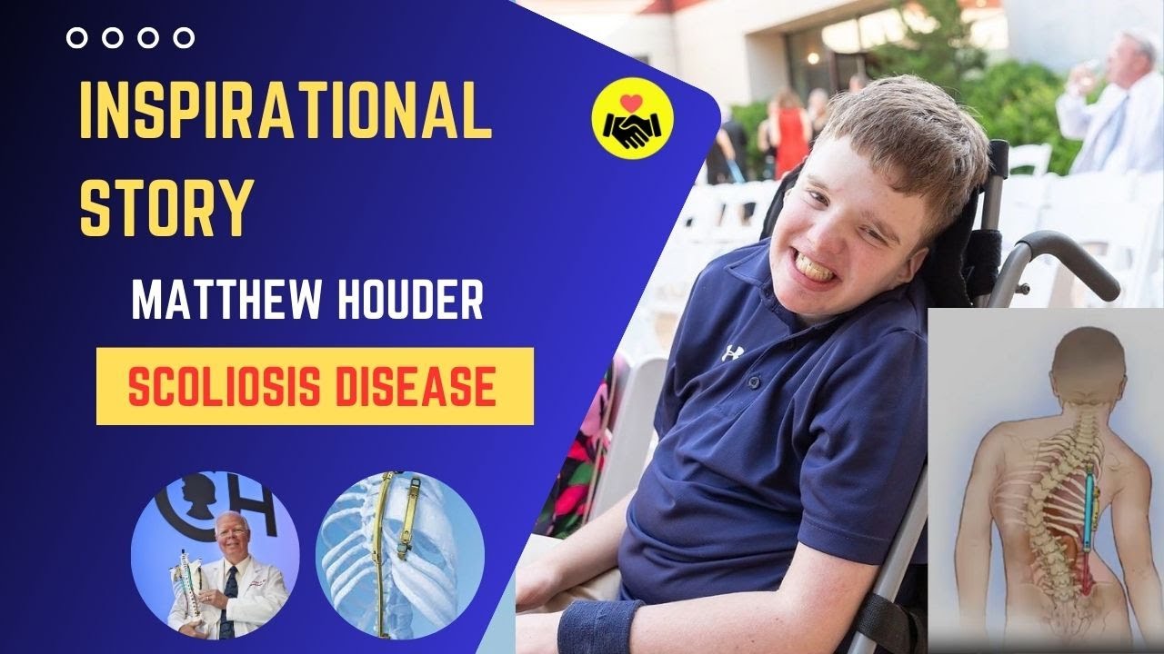 Story of the Patient | scoliosis | | VEPTR | #motivation #inspirational ...