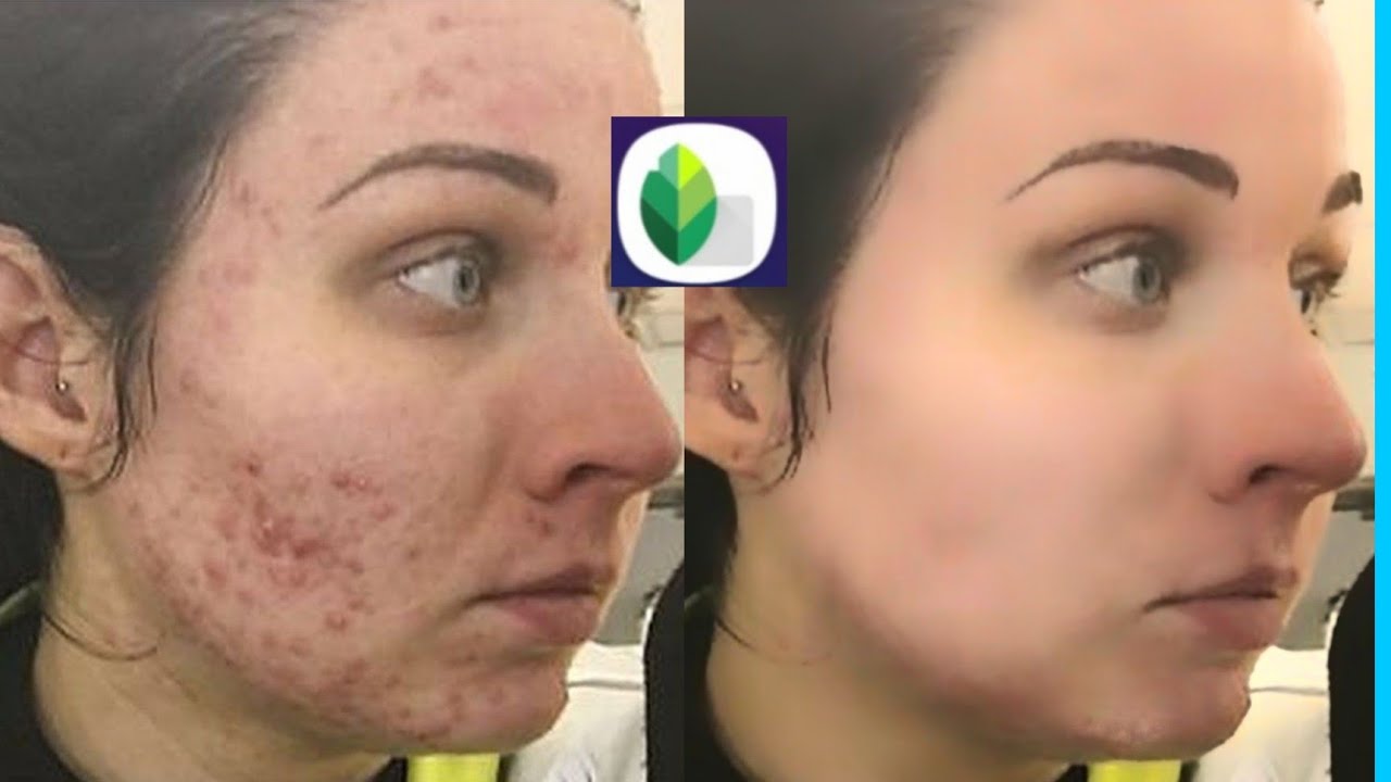 face smooth editing secret tricks || Snapseed amazing smooth skin - YouTube