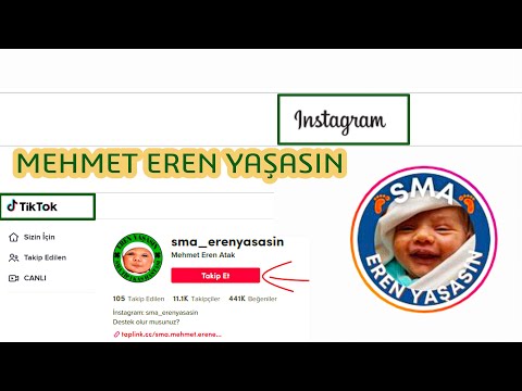 EREN BEBEĞE DESTEK VERİN !  (Türkiyenin SMA Teşhisi Konulmuş En Küçük Bebeği)