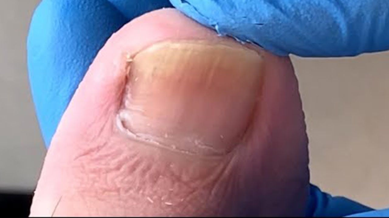 Pedicure Tutorial :a Comfortable Pedicure【xue Yidao】 Youtube