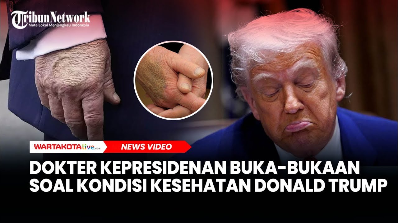 Dokter Kepresidenan Buka-Bukaan Soal Kondisi Kesehatan Donald Trump ...