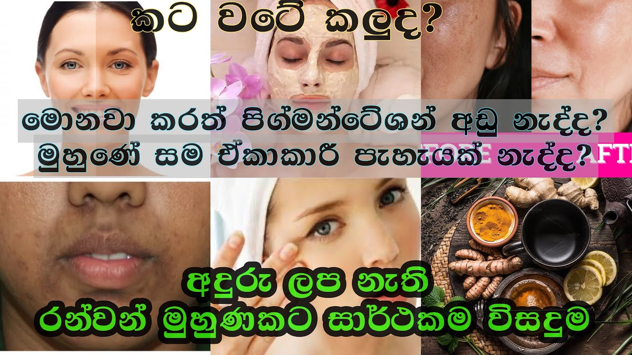 How to Remove pigmentation මුහුණේ කලු පැල්ලම් වලට විසදුම| glowing skin ...
