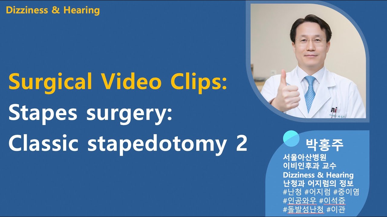 Surgical video clips_Classic stapedotomy 2 - YouTube
