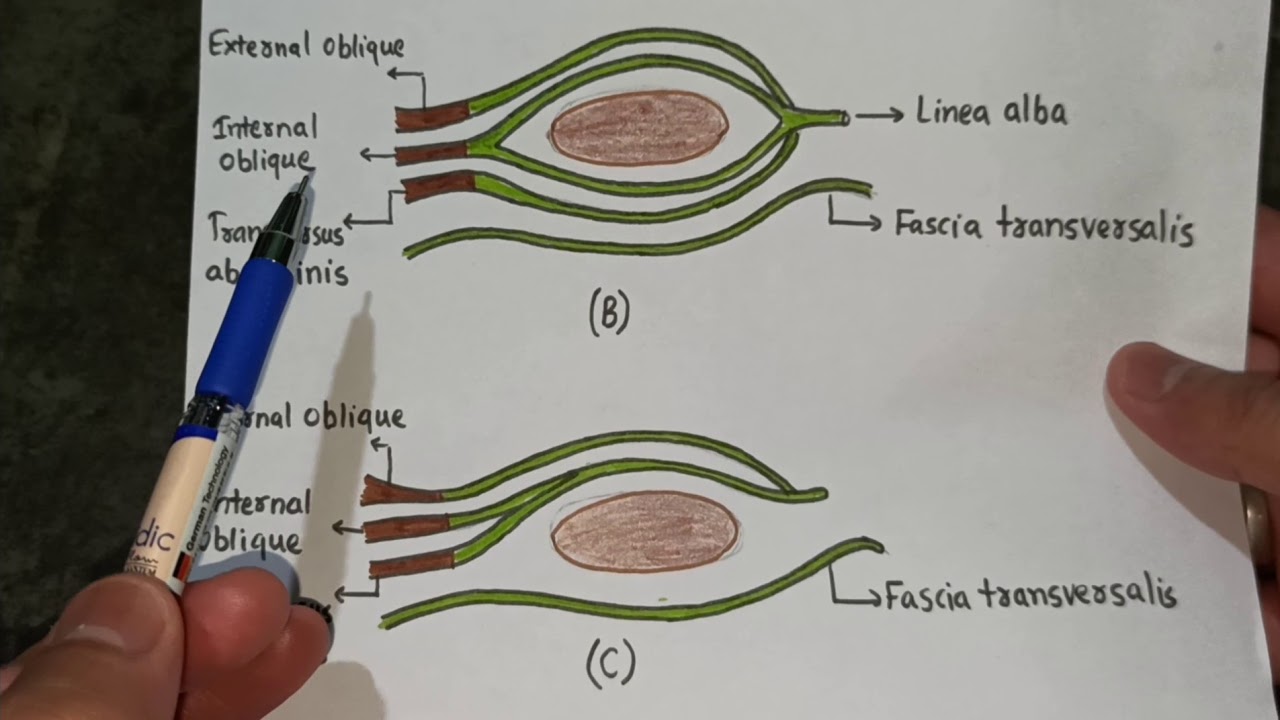 RECTUS SHEATH - YouTube