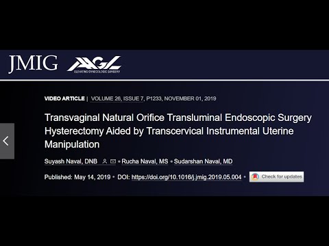 VAGINAL NOTES HYSTERECTOMY- ATRIUM technique - YouTube