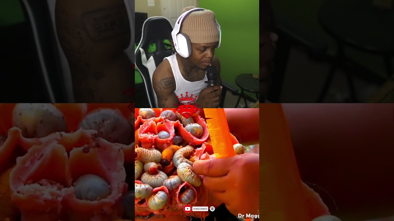 Best Pimple Popping | Tick Removal | Tiktok Reaction | Satifying Video ...