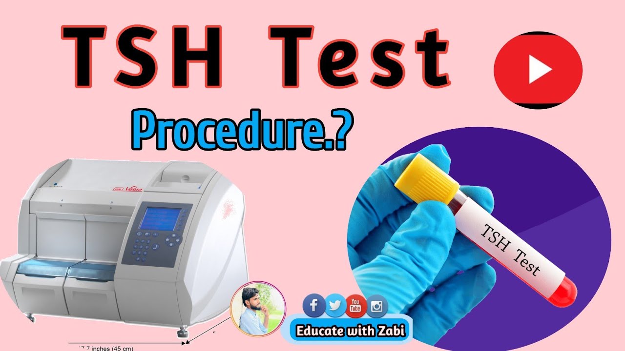 How To Do the TSH Test? د TSH ټیست پروسيجر - YouTube