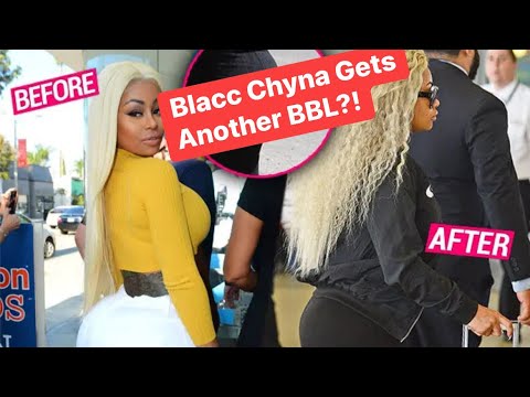 Blacc Chyna Gets Another BBL?! - YouTube