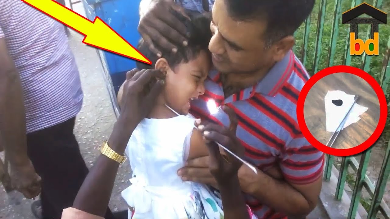 3 Years Baby Nicely Relief For Future II Stone Removed Successfully ...