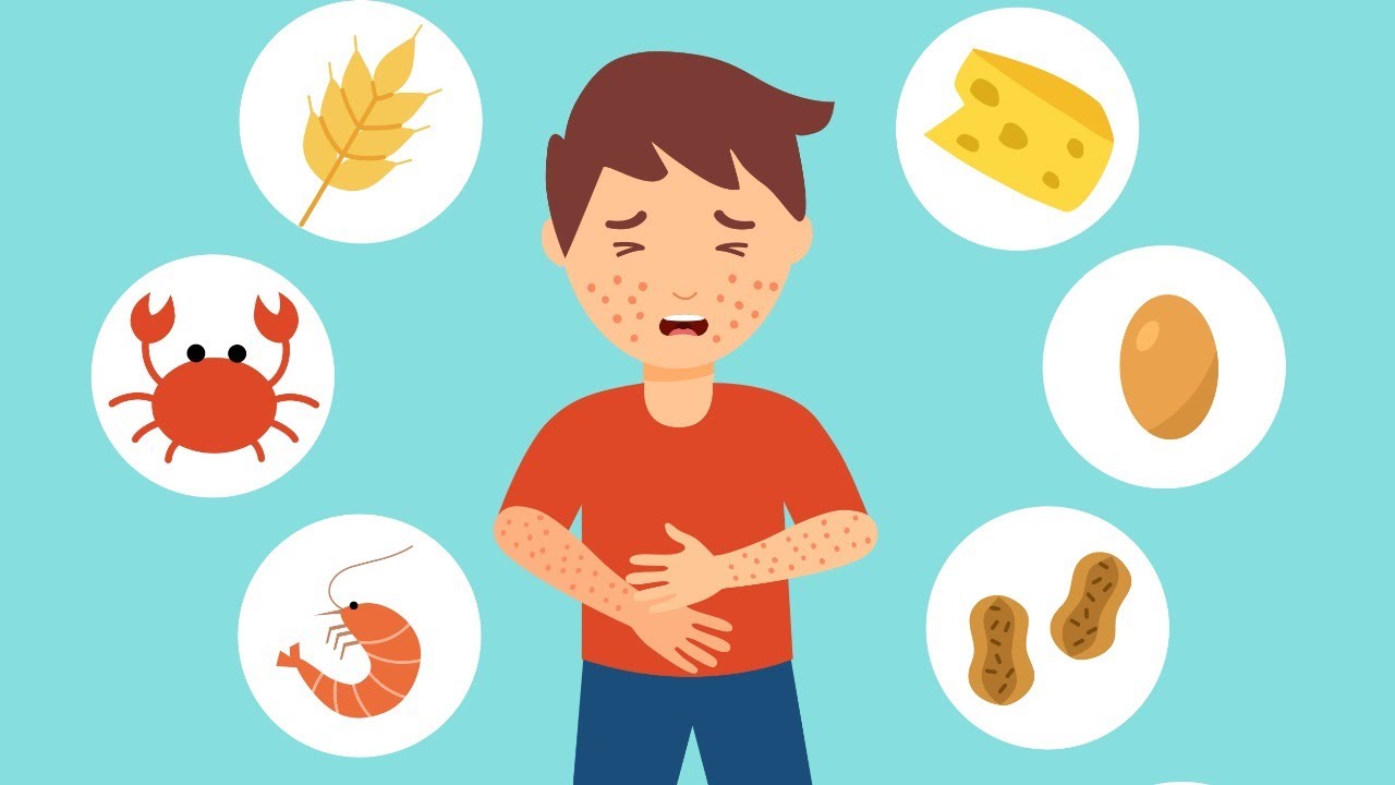 Διάγνωση και παρακολούθηση τροφικής αλλεργίας: κλινικοί και βιολογικοί ...