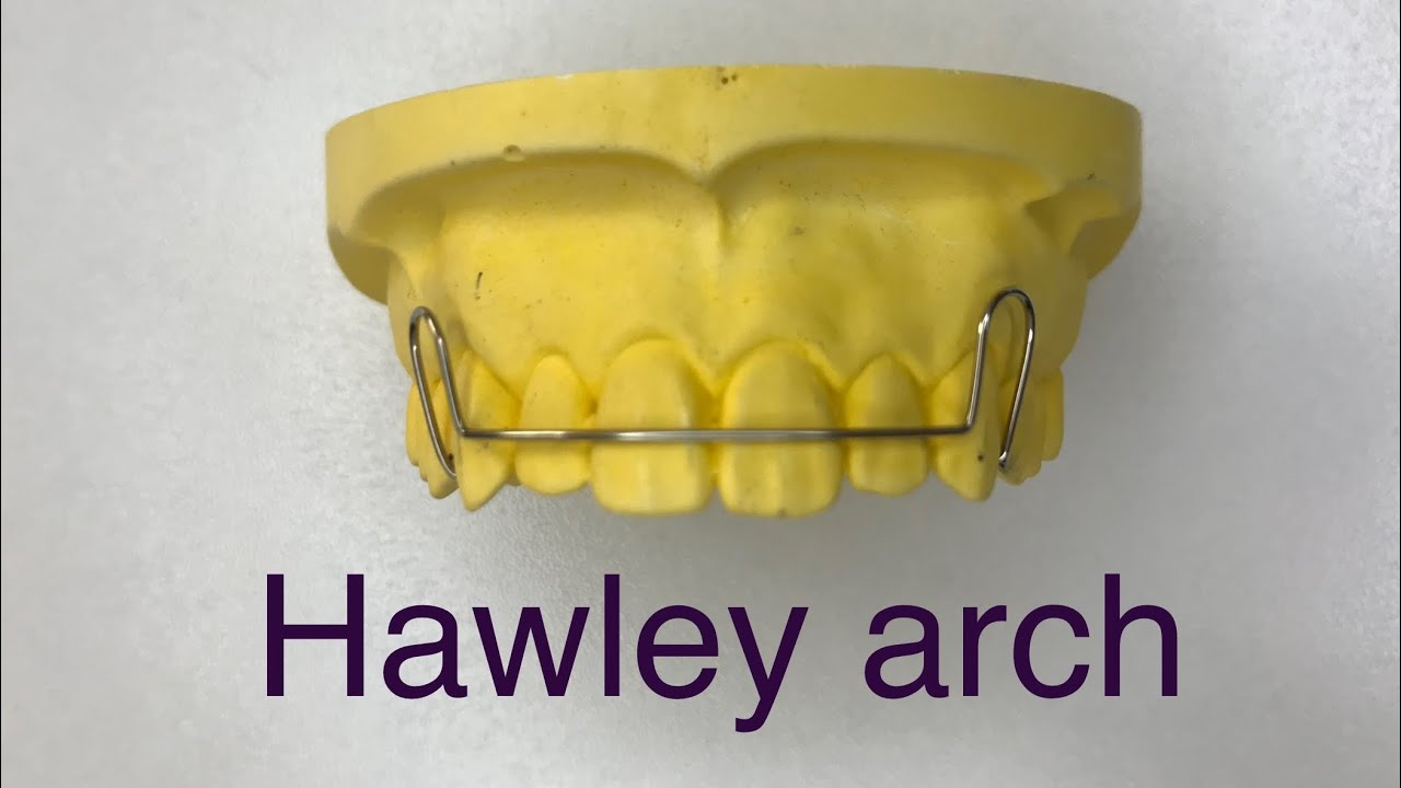 Wire bending series: Episode XIV Hawley arch - YouTube