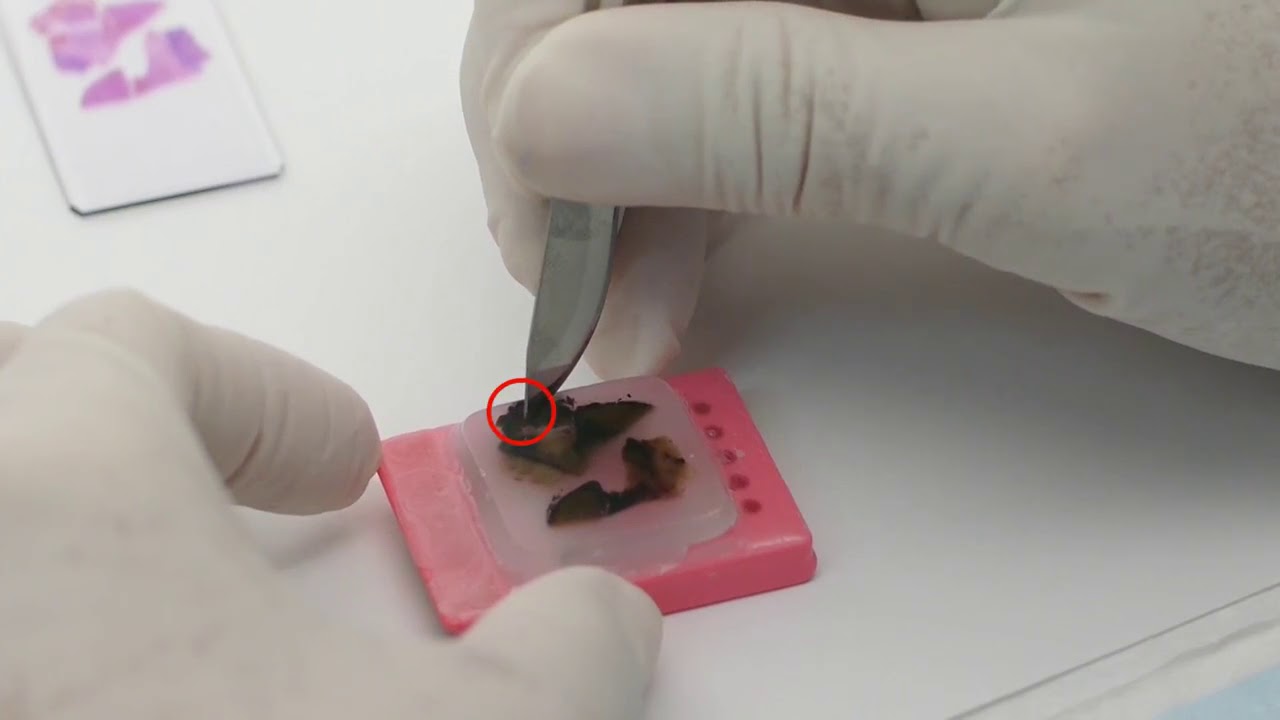 การเตรียมสิ่งส่งตรวจ Paraffin block specimen - YouTube