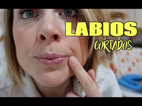 REMEDIOS PARA MIS LABIOS CORTADOS | VLOG COCINANDO CON NURY CALVO ...
