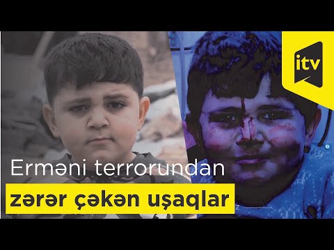 Erməni terrorundan zərər çəkən uşaqlar
