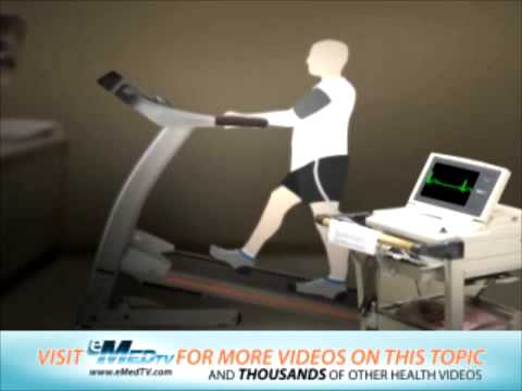 Exercise Stress Test - YouTube