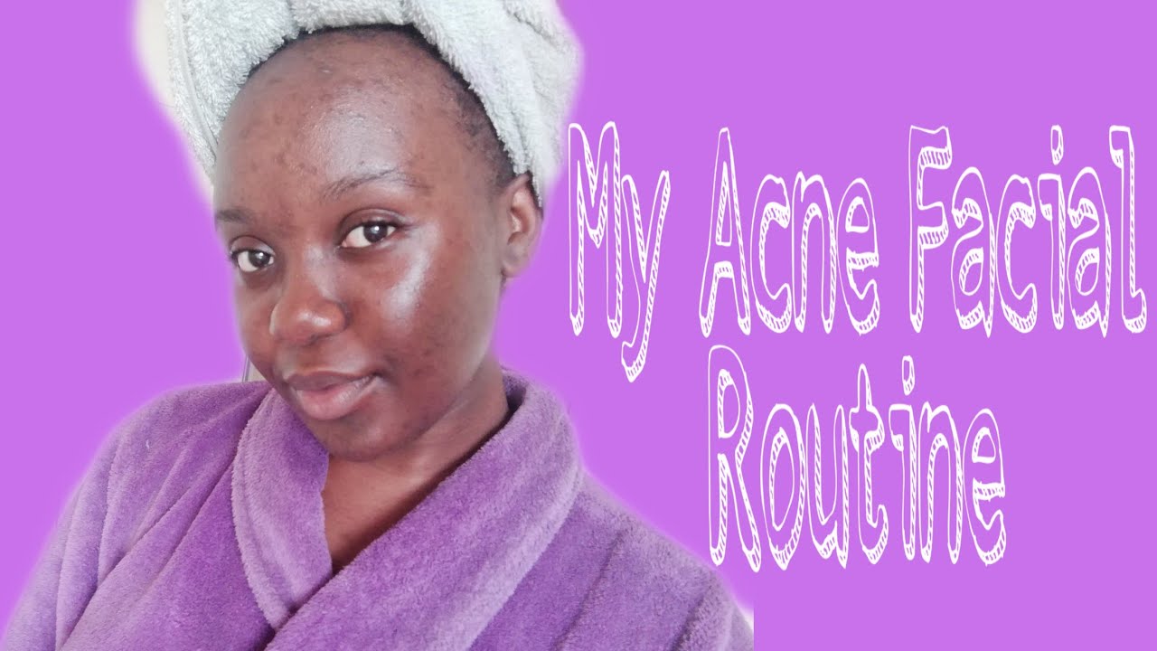 Beauty Tips | Colgate Face Mask | Acne Treatment - YouTube