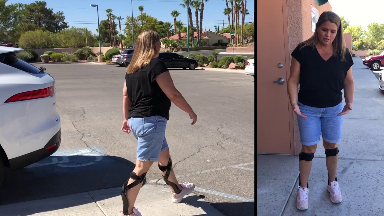 Patient Videos › Helios Bracing