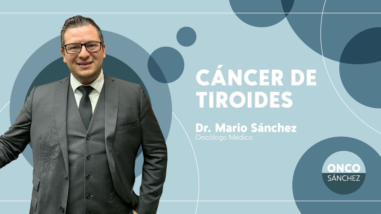 Cáncer de Tiroides con el Dr Mario Sanchez Prieto - YouTube