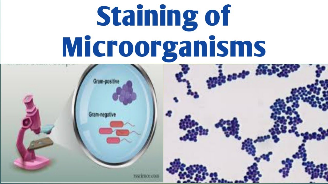Staining of Microorganisms| Pharmaceutical Microbiology #jitendrapatel ...