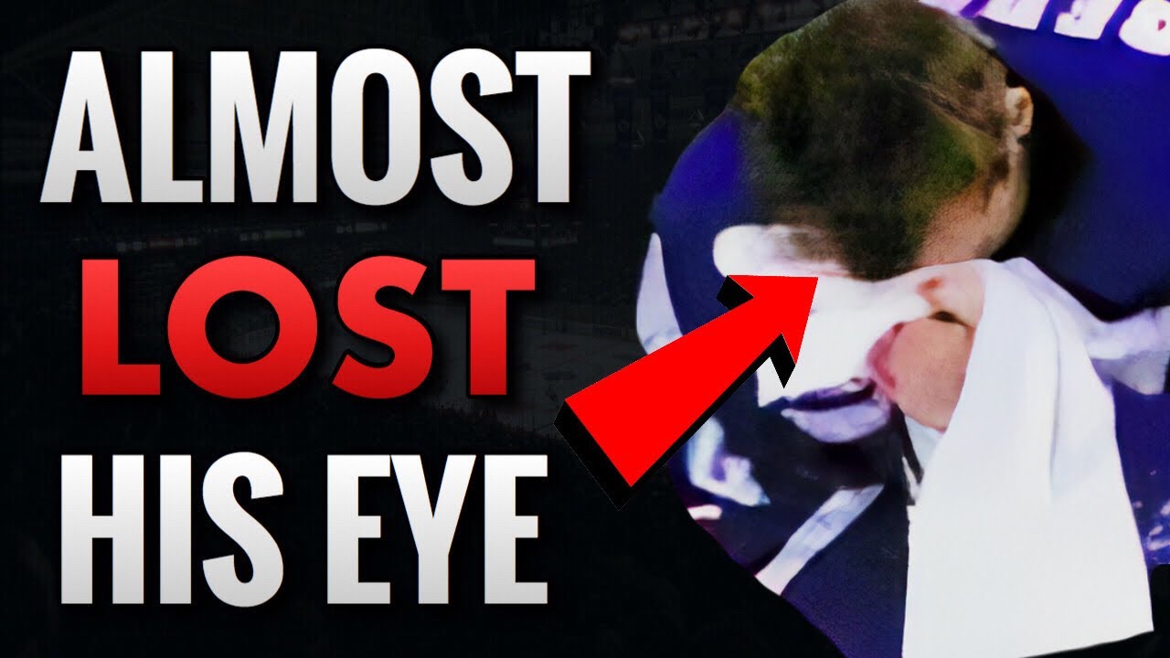 Meet the NHL Player Who Almost LOST HIS EYE - YouTube