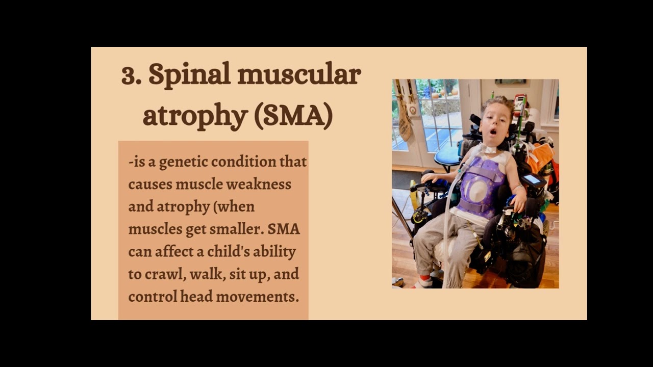 GROUP7 BRAINLESS Learning Characteristics of Learners with difficulty ...