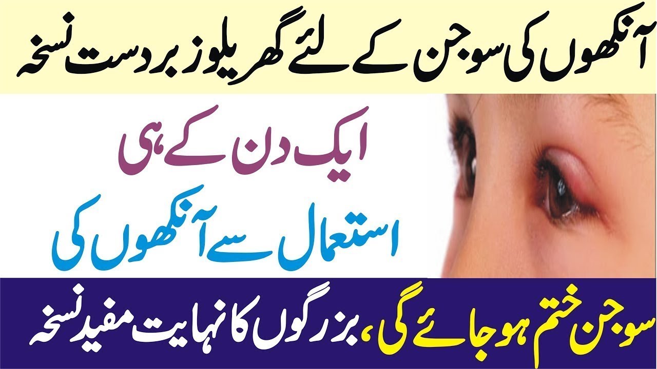(Ankhon ke soojan ka ilaj) in urdu - Aankhon ki Sujan Ka Ilaj | Tips ...